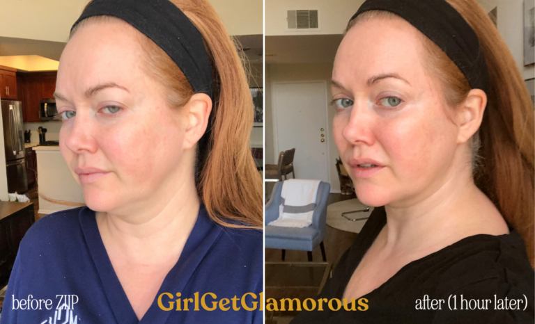 ZIIP Beauty Device: My 4 Year Update + Your Top 10 Questions Answered ...