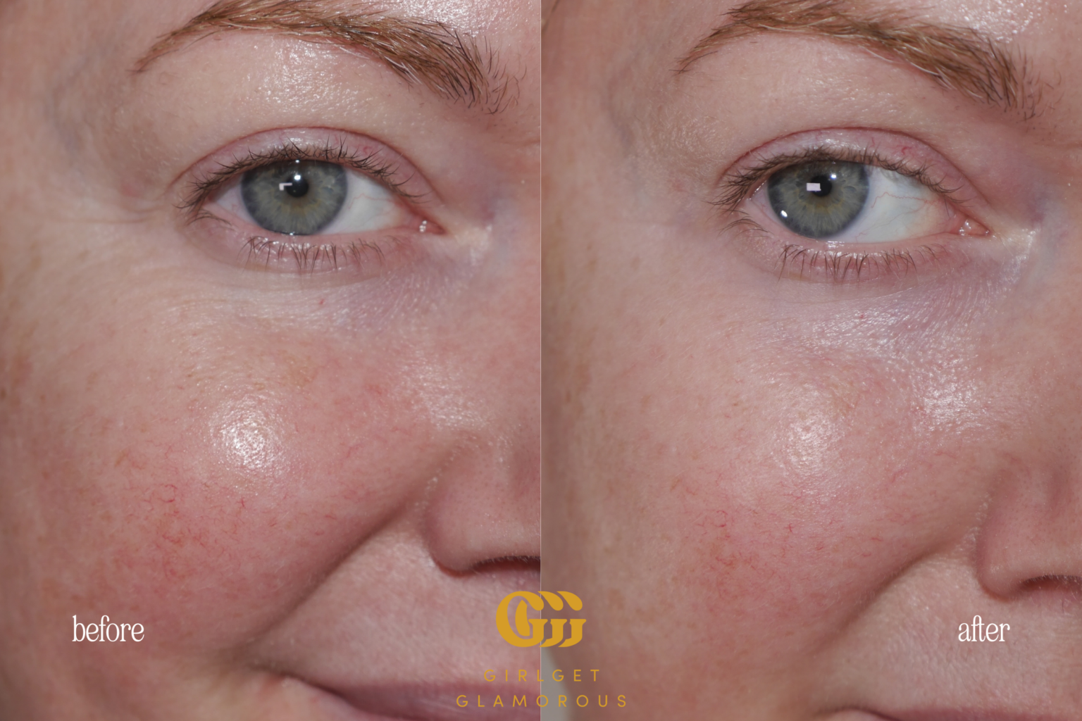 The Best Eye Patches for Smoothing Under Eye Bags • GirlGetGlamorous