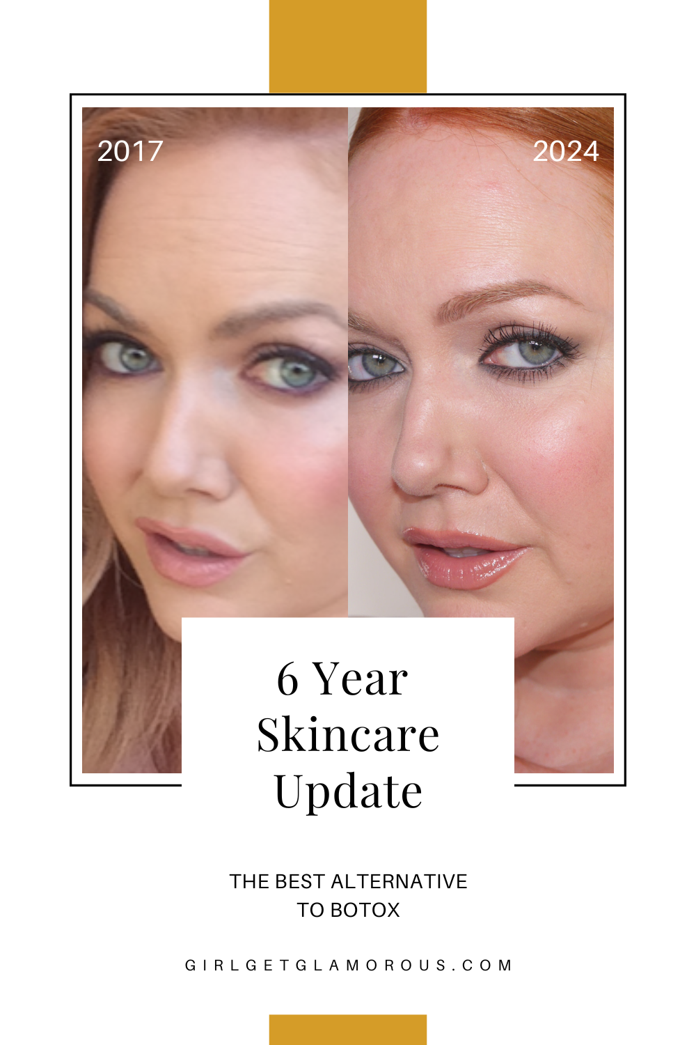 Six Years of Using the ZIIP Beauty Facelift Device | Before + After ...