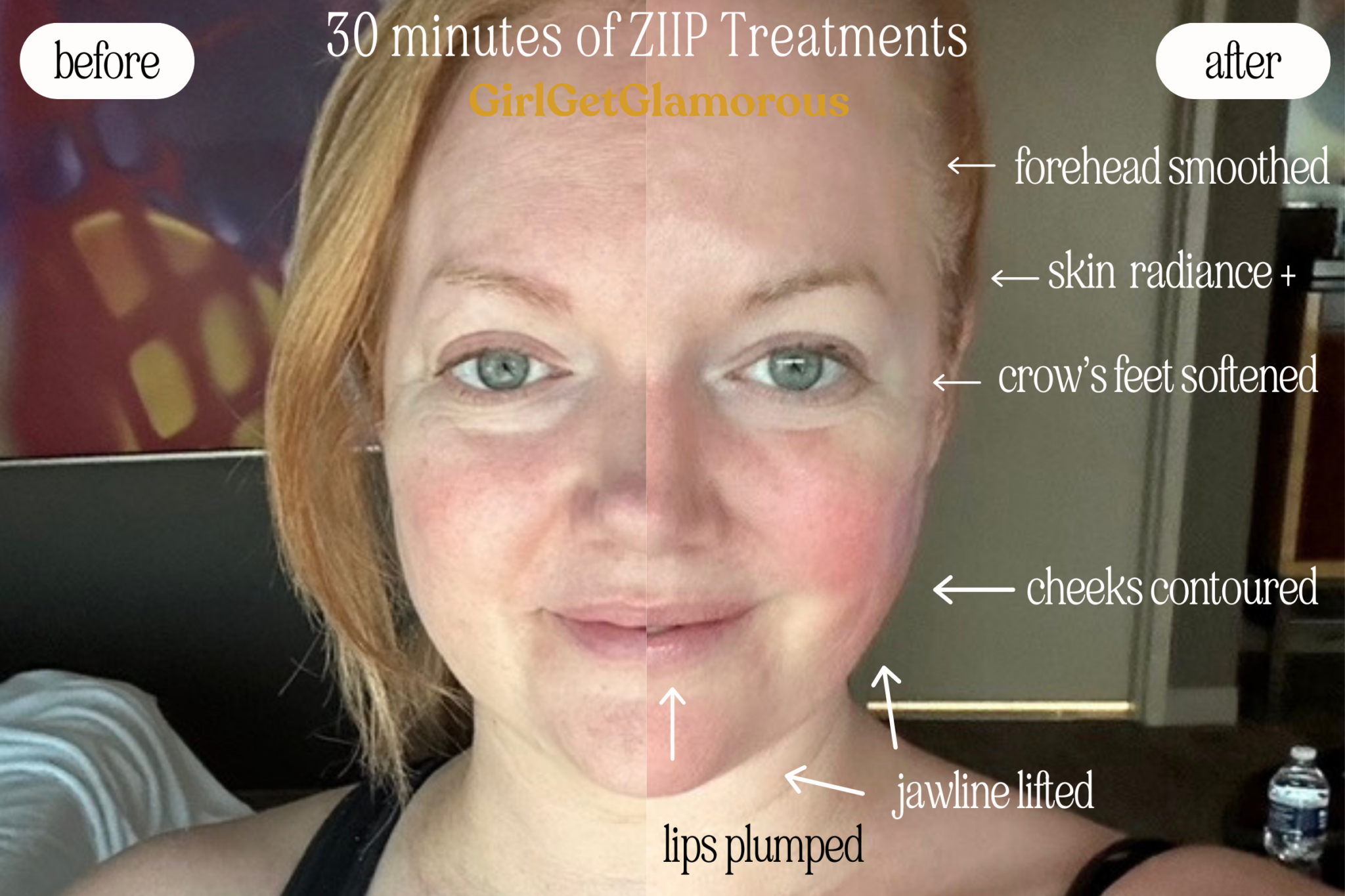 How to Use the ZIIP Halo Device • GirlGetGlamorous