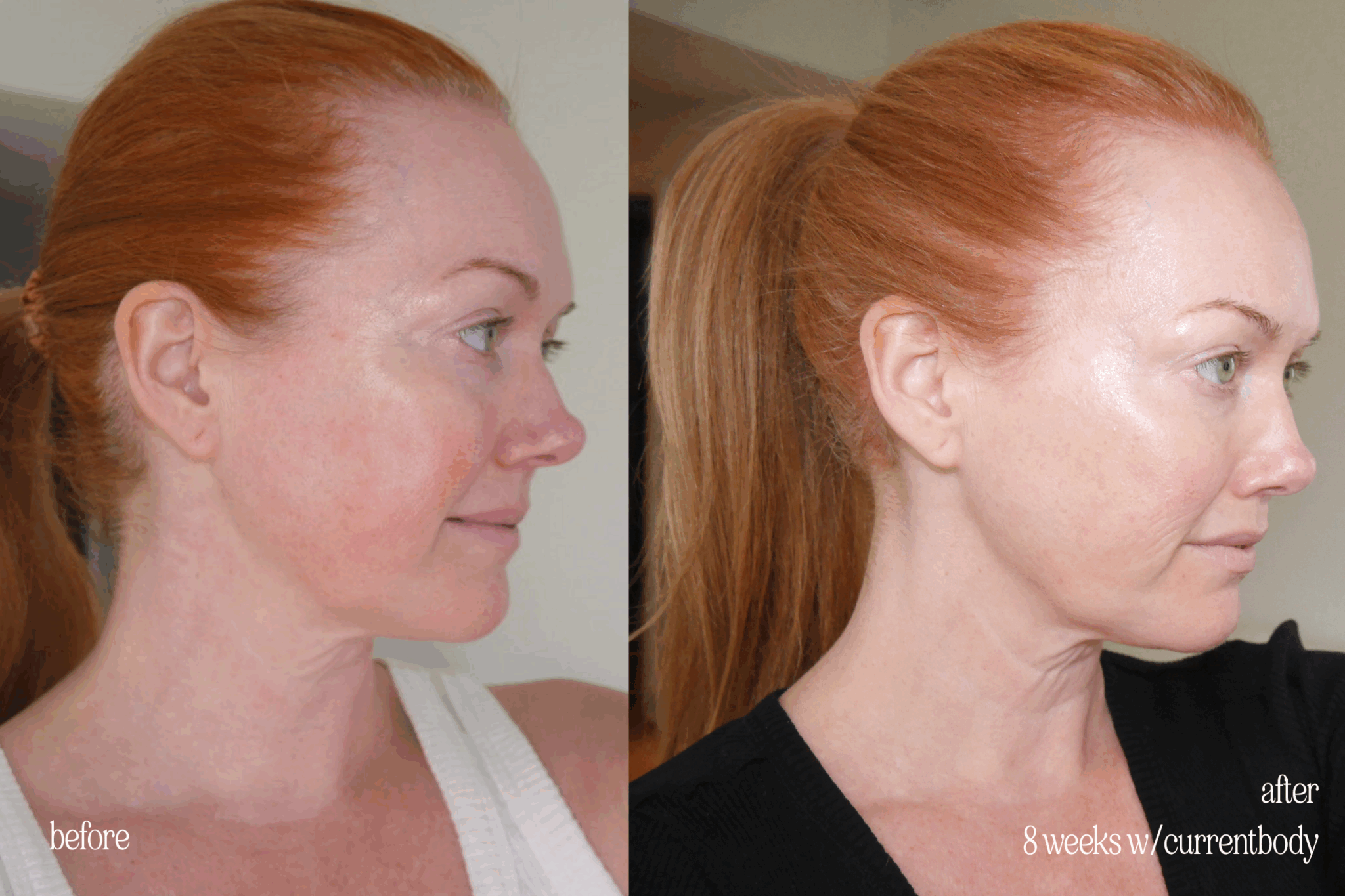 Currentbody Skin LED Red Light Hair Regrowth Helmet Review ...